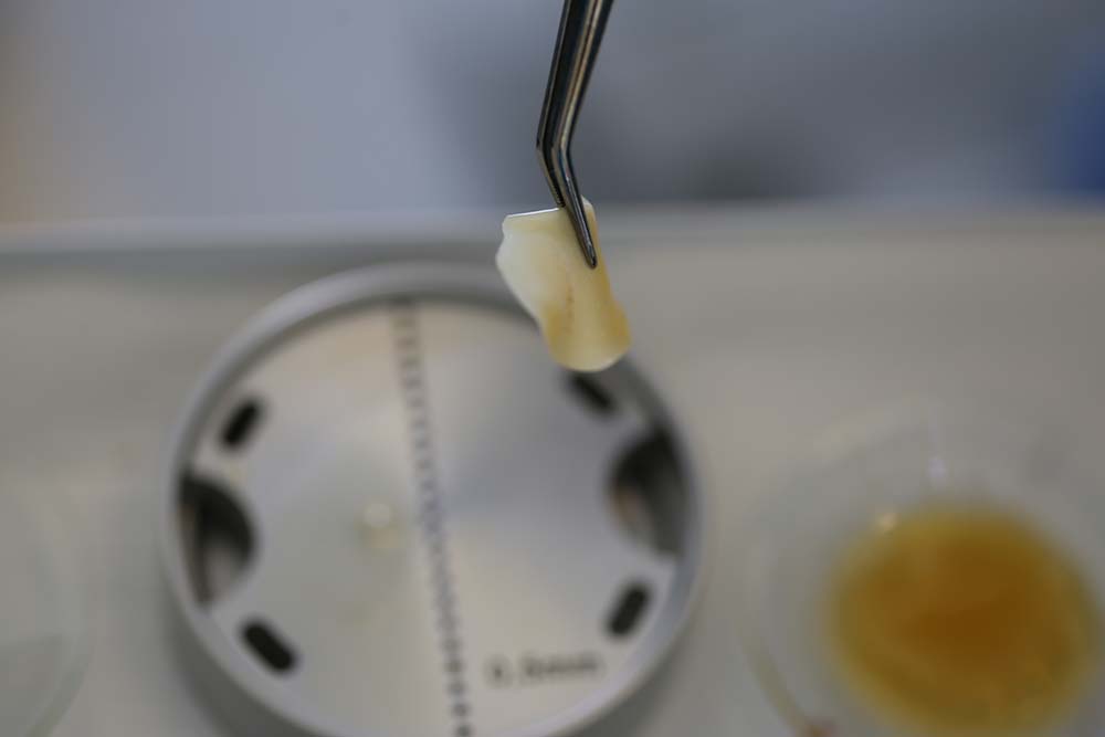 PRGF - Waterside Dentalcare